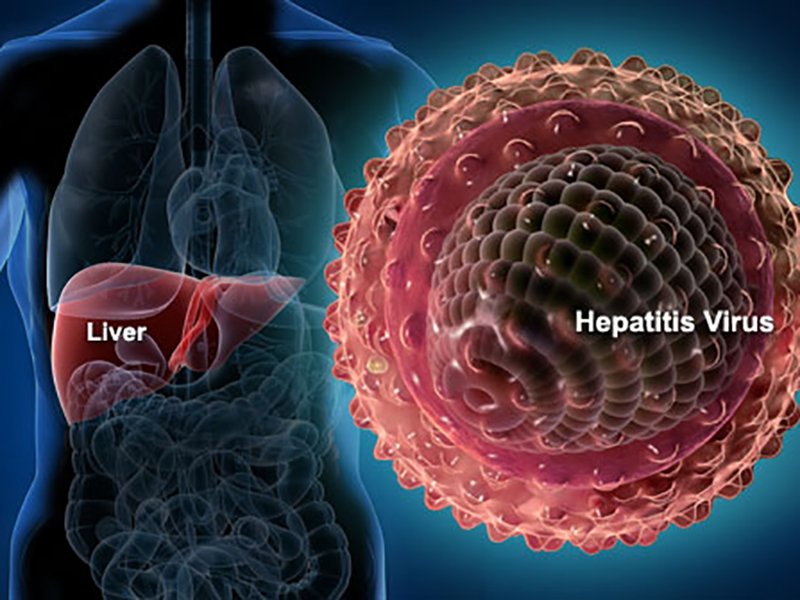 Epatiti virali, Simit-Aisf: “Priorità prevenzione, screening e trattamento” - Ore12